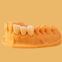 China SHT-ML High Translucency Dental Zirconia Blanks Wholesale For CAD/CAM Dental Labs for sale