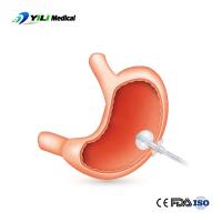 China Medical Silicone Gastrostomy Tube 12Fr to 24Fr PEG Feeding Tube 240mm Length for sale