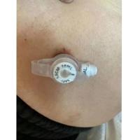 China Medical Grade Silicone Low Profile Button Gastrostomy Tube 12Fr to 24Fr for sale