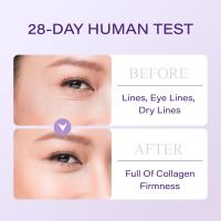China Polypeptide Anti Wrinkle Removing Moisturizer Face Skin Care Products Anti Aging Lyophilized Powder Freeze-dried Floccover for sale