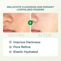 China Custom-Made Anti-aging Serum Skincare Beauty Moisturizer Skin Care Product Oligopeptide-1 Nicotinamide Lyophilized Powder for sale