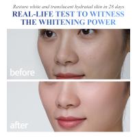 China Private Label Anti-acne Repair Whitening Moisturizing Skin Rejuvenation Niacinamide Powder Ampoule Serum Set for Salon for sale