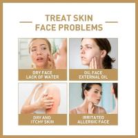 China OBM OEM Factory Wholesale Price Whitening Korean Skin Care Facial Toner Hydration Rice Toner Water Nicotinamide for Dry Skin for sale