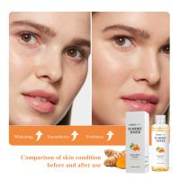 China OEM Custom Beauty Products Tumeric Face Essence Liquid Manufacturer Removes Freckles Repairs Shrink Pores Whitens Skin for for sale
