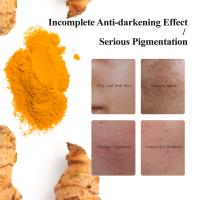 China Wholesale Customization Organic White Skin Whitening Acne Toner Facial Beauty Skincare Tumeric Face Skin Toner for Face for sale