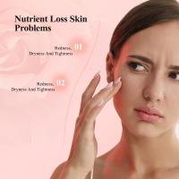China Factory Wholesale Custom Private Label Rose Serum Water Pore Shrinking Moisturizing Spray Prevent Makeup Getting Stuck Free for sale