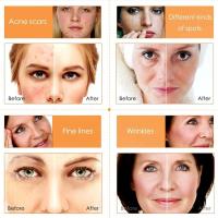 China Customized Private Label Vitamin C Serum Anti-Aging Anti-Wrinkle Spot Lightening Morning Evening Moisturizing Whitening Feature for sale