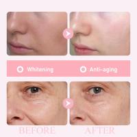 China OEM Professional Factory 5 in 1 Anti-aging Acne Remova Moisturizing Whitening Repair  Face Serum Beauty Personal Care Products for sale