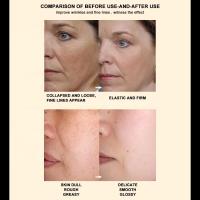 China OEM Custom ProXylane Cream for Anti-Aging Anti-Wrinkle Lifting Firming Anti-Oxidant Moisturizing Niacinamide for Beauty Salon for sale