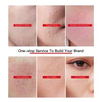 China OEM Factory Gentle Sensitive Skin Cleanser Home Use Facial Cleansing Mousse Recombinant Type III Humanized Collagen for sale