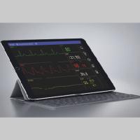 China Veterinary Spo2 Monitor With Internal Memory And Bluetooth Data Transfer for sale