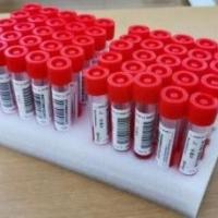 China GF30 Disposable Medical Plastic Parts Injection Mold for Syringe Equipment - IATF 16949 Certified Custom Manufacturing for sale