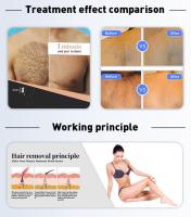 China Safe Hair Removal with COSMEDPLUS 3 Wavelength 755 808 1064 Diode Laser Machine in Lebanon for sale