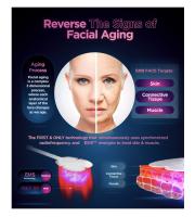 China EMS Technology V-face Wrinkle Removal Anti Aging Machine for Portable Facial Firming for sale