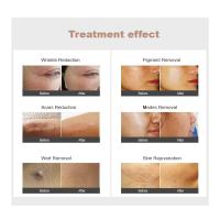 China Professional 60W RF Tube Q-Switch Fotona Fractional CO2 Laser Skin Resurfacing Machine for sale