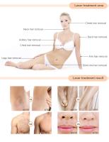 China 1200W 1600W Fiber Diode Laser Hair Removal Machine with Multifunctional 3 Wave Laser for sale