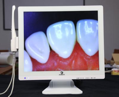 China 17 Inch wired Dental Intraoral Camera, dentist's must have communication Tool, share photo to smartphone by QR code for sale