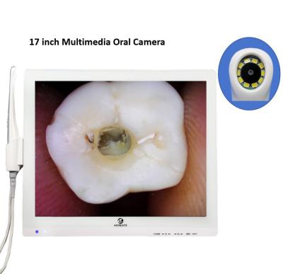 China Intraoral Dental Examination And Diagnosis Intraoral Imaging Device Supporting Video Format MP4 To Deliver Dental Visual Data for sale