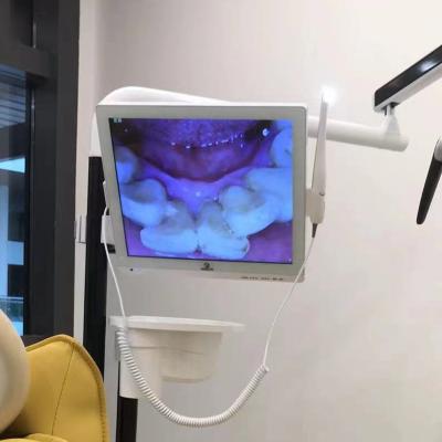 China Magnification Up To 100x Wireless Intraoral Camera with MP4 Video Format Designed to Improve Dental Examination Accuracy for sale