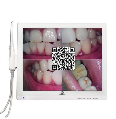 China Medical Grade Plastic and Metal Digital Intraoral Camera Providing Universal Compatibility Supporting Workflow in Dental Clinics for sale