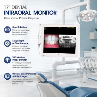 China Lightweight Design High Resolution Intraoral Camera Offering Ease of and High Definition Visualization During Procedures for sale