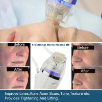 China Golden Nano Fractional RF Microneedling Devices For Home Acne Removal for sale