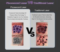 China Super Picosecond Picolaser Tatoo Remover Q Switched Pico Second Laser Tattoo Removal Machine for sale