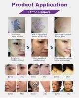 China Super Picosecond Picolaser Tatoo Remover Q Switched Pico Second Laser Tattoo Removal Machine for sale