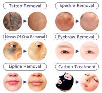 China Portable Pico Second Laser Tatoo Remover Q Switched Nd Yag Picosecond Tattoo Removal Machine for sale