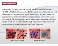 China Professional Portable Pico Laser Tatoo Remover Q Switched Picosecond Picolaser Tattoo Removal Machine for sale