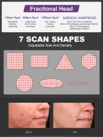 China Professional Vertical 10600nm Fractional Co2 Laser Skin Resurfacing Machine Vaginal Tightening for sale