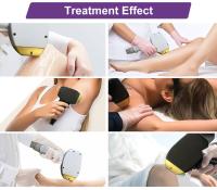 China Professional Lazer Beauty Device 808 755 1064 Painless Diode Laser Hair Removal Machine for sale