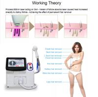 China DPL Trending products 2023 portable triple wavelength diode laser 755 808 1064 808nm diode laser hair removal machine for sale