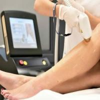 China Newest Diode Laser 808 nm Diode Laser Hair Removal Machine Price for sale