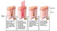 China CE Approved Facial Equipment Intense Pulse Light   OPT IPL Laser Hair Removal Device for sale