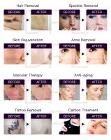 China 2021 Multiifunction Laser IPL OPT   Hair Removal Facial RF Acne Treatment Nd Yag Laser Tattoo Hair Removal Machine Painless for sale