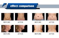 China 40 Khz Vacuum Ultrasound Cavitation System RF Therapy Body Detox Sculpting Fat Burner Device Weight Loss Slimming Machine for sale