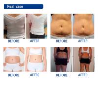 China Fat Freeze Cavitation Cryolipolysis Slimming Machine Cellulite Reduce With 4 Handles for sale