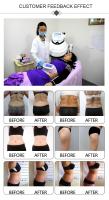 China DM-55 Portable RF Cryolipolysis Slimming Machine 350mW pulse  Fat Freezing for sale