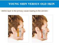China Face Lifting Rf 2 In 1 Radio Frequency Machines Body Slimming With 3 Handle for sale