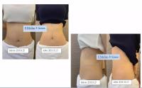 China EMT-8 Electro Muscle  Stimulator Portable Ems Sculpting Machine 1500W Slimming for sale