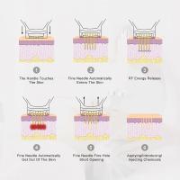 China Customized Fractional Face Lift Professional Rf Microneedling China Beauty Machine Factory for sale