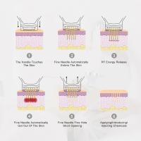 China Customized RF Microneedling Machine CE Certified Skin Rejuvenation China Beauty Machine Manufactuer for sale