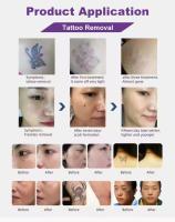 China P1 Professional Vertical Pico Second Laser 755 1064nm Picosecond Laser Tattoo Removal Machines For Melasma for sale