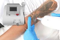 China DPL Professional Q Switched Nd Yag 1064nm Carbon Peel Eyebrow Tattoo Removal Laser Machine for sale