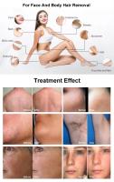 China D32 Portable 808nm Professional Homeuse Diode Laser Hair Removal Machine Seeking Agents for sale
