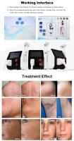 China D32 Portable 808nm Professional Homeuse Diode Laser Hair Removal Machine Seeking Agents for sale