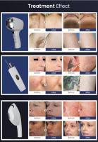China D31-3 Professional Ipl Hair Removal 808nm Diode Laser Carbon Peel Nd Yag Picosecond Laser With Measuring Rod for sale