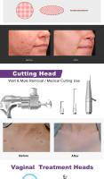China V10 30w 60w Portable Scar Removal Private Tightening Co2 Fractional Laser Beauty Machine For C02 Collagen Wrinkle Remove for sale