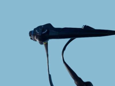 China BF-P160 Bronchoscope 120 Degree Field of View 4.9mm Flexible Scope for sale